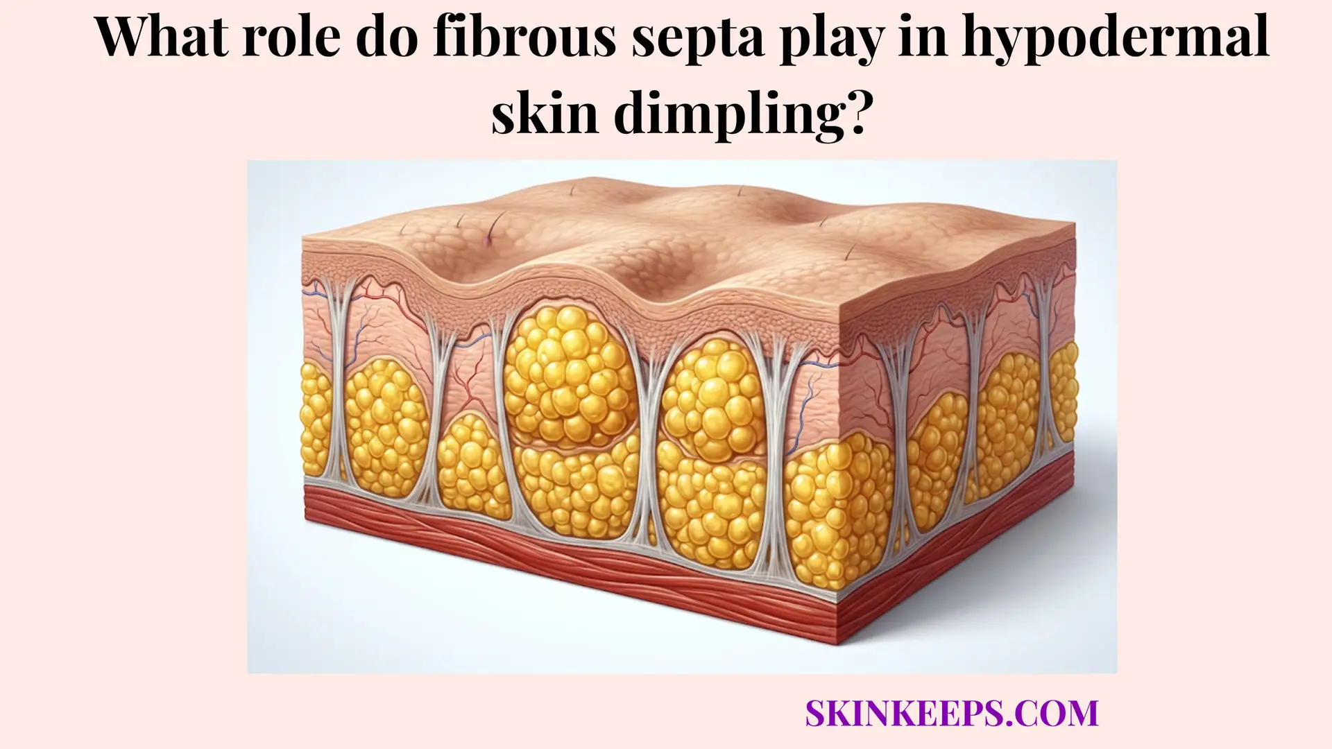What role do fibrous septa play in hypodermal skin dimpling?